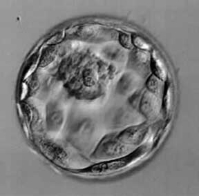 day-5-blastocyst | DiarioAbiertoDiarioAbierto